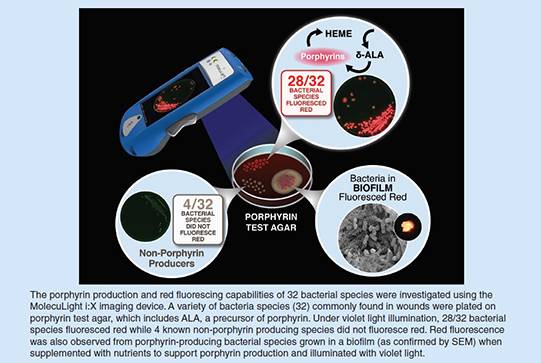 First Reports In Vitro Detection of Fluorescence from Bacteria