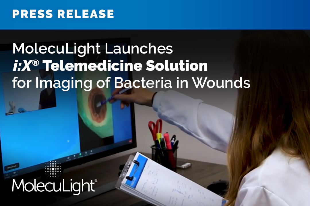 MolecuLight Launches the i:X® Telemedicine Solution for Imaging of ...