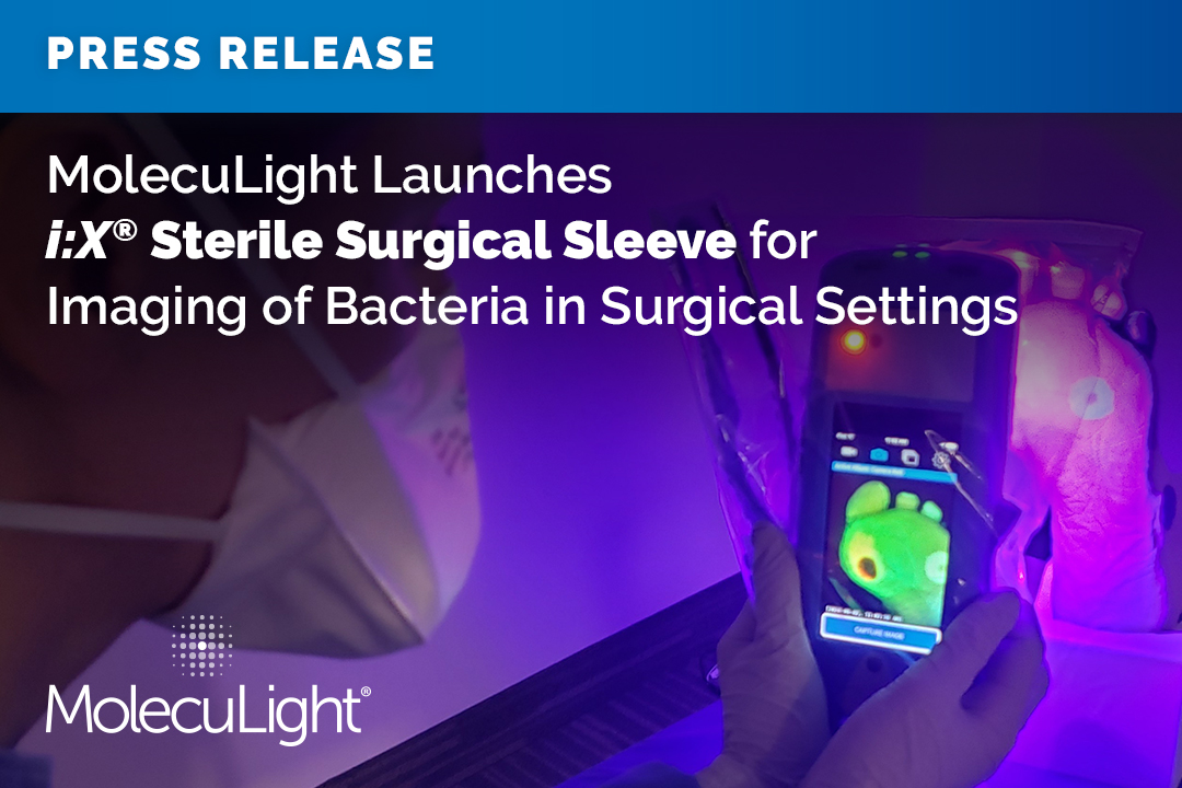 MolecuLight Launches i:X® Sterile Surgical Sleeve for Imaging of ...