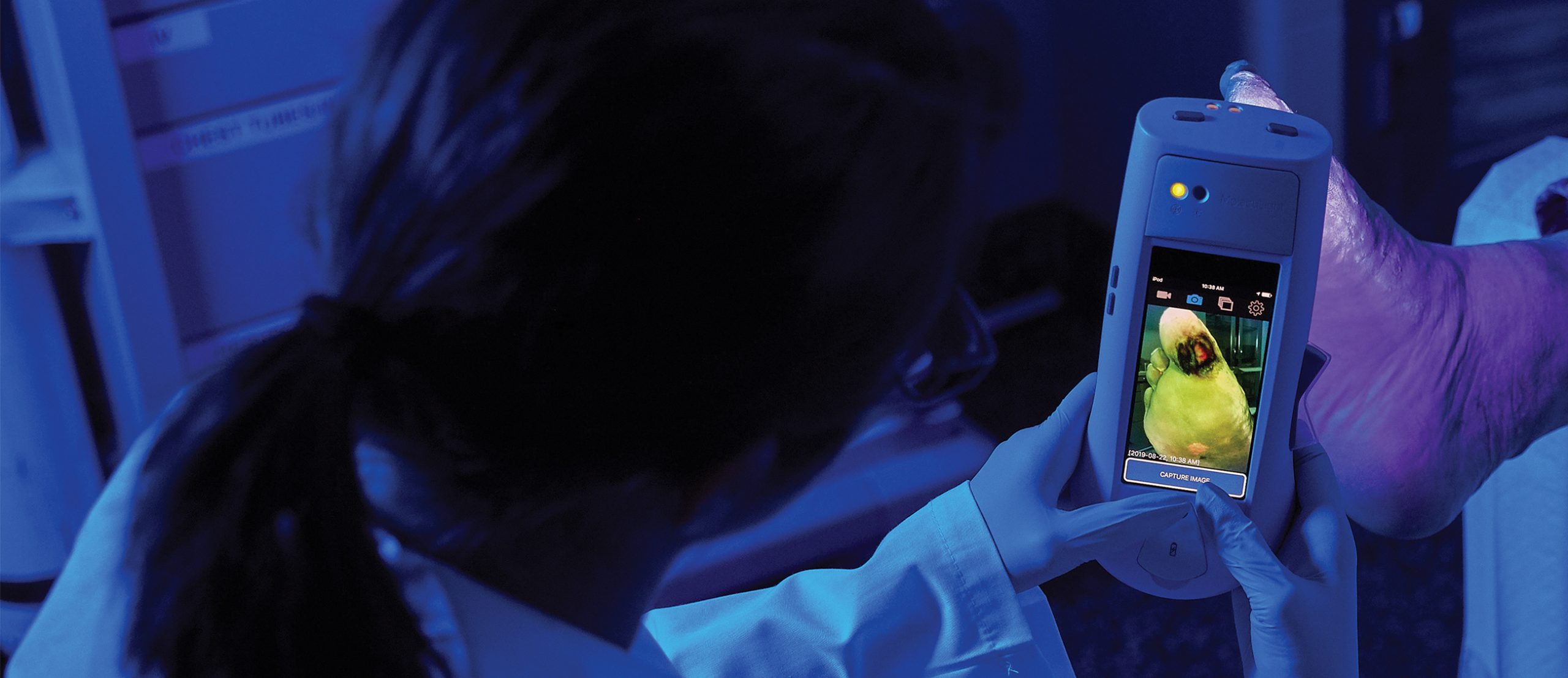 Advanced Wound Care | Wound Healing Technologies | MolecuLight