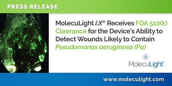 MolecuLight i:X® Receives FDA 510(k) Clearance for the Device’s Ability ...