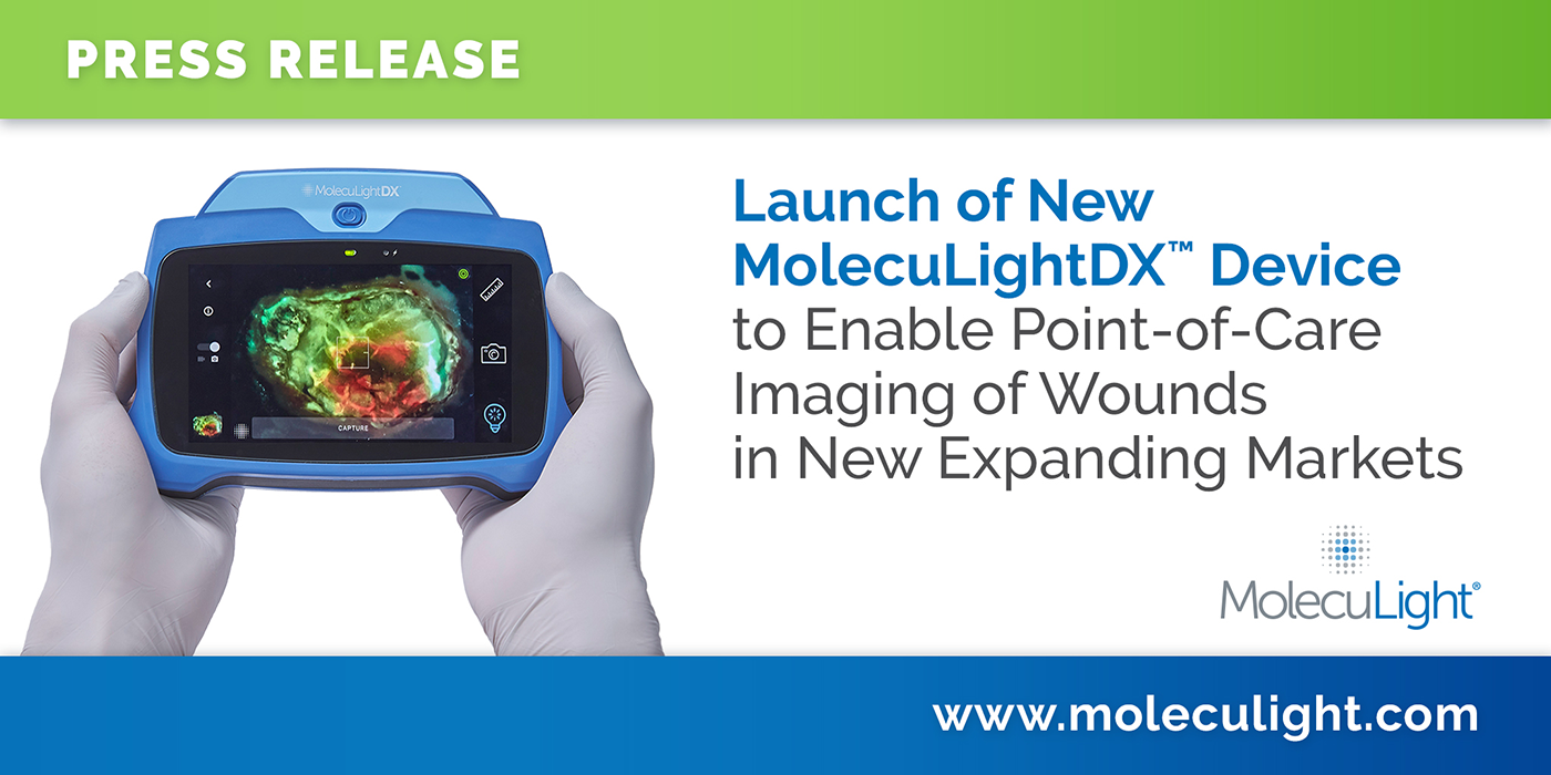 Launch of New MolecuLightDX™ Device to Enable Point-of-Care Imaging of ...