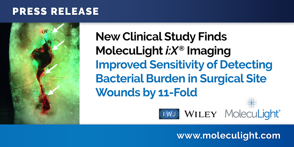 New Clinical Study Finds MolecuLight i:X® Point-of-Care Imaging ...